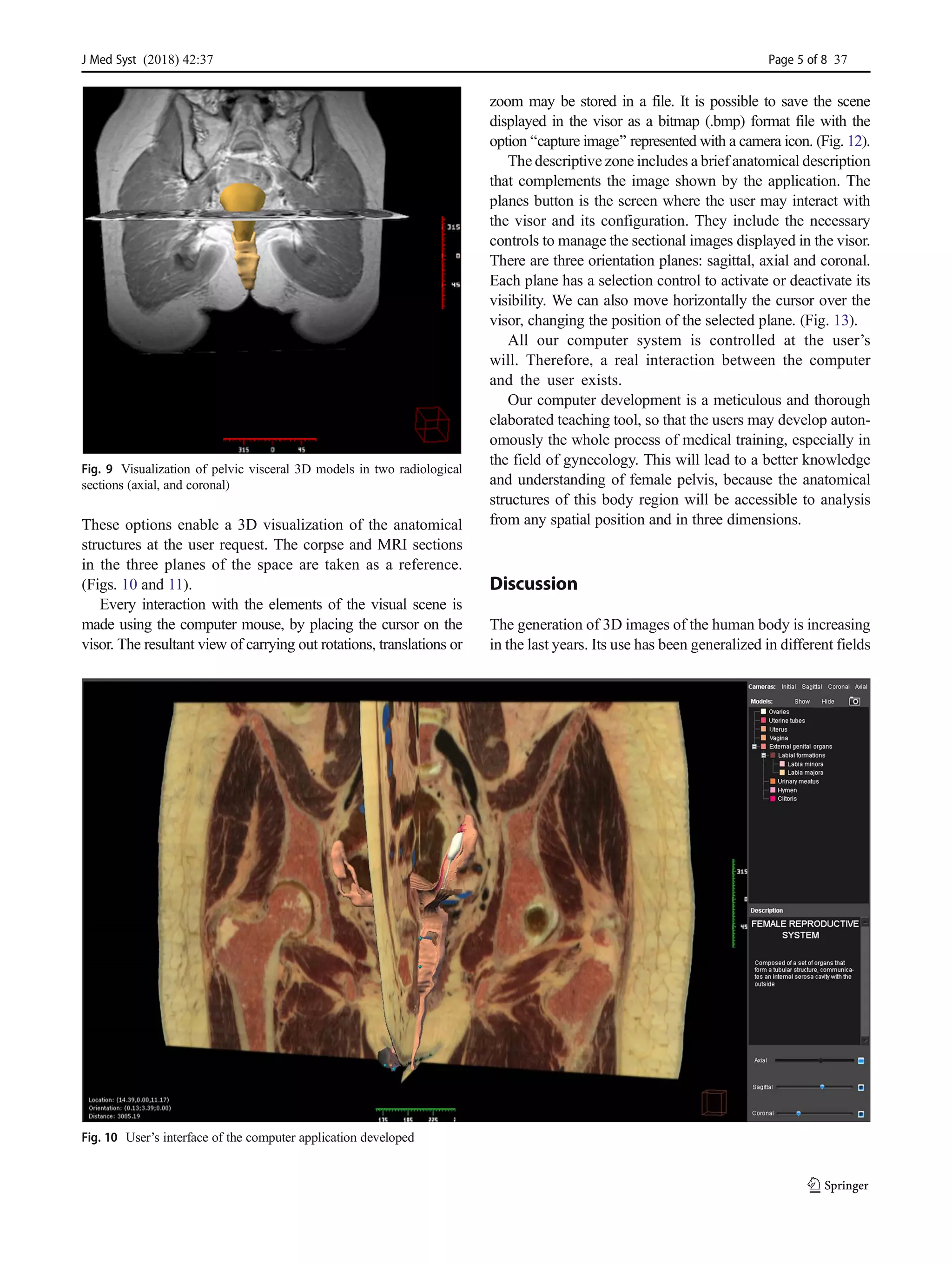 3 d models of female pelvis structures reconstructed | PDF