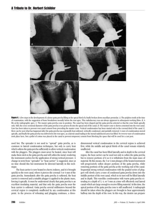 Filling Root Canals in Three Dimensions | PDF