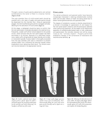 THREE-DIMENSIONAL OBTURATION OF THE ROOT CANAL SYSTEM* by Clifford J ...