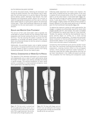 THREE-DIMENSIONAL OBTURATION OF THE ROOT CANAL SYSTEM* by Clifford J ...
