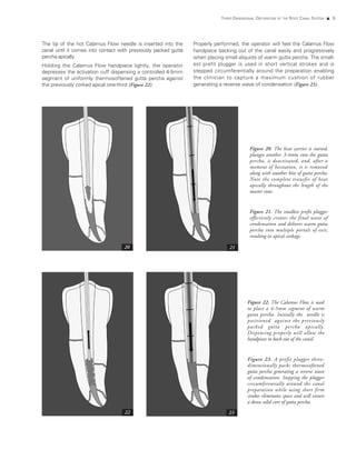 THREE-DIMENSIONAL OBTURATION OF THE ROOT CANAL SYSTEM* by Clifford J ...
