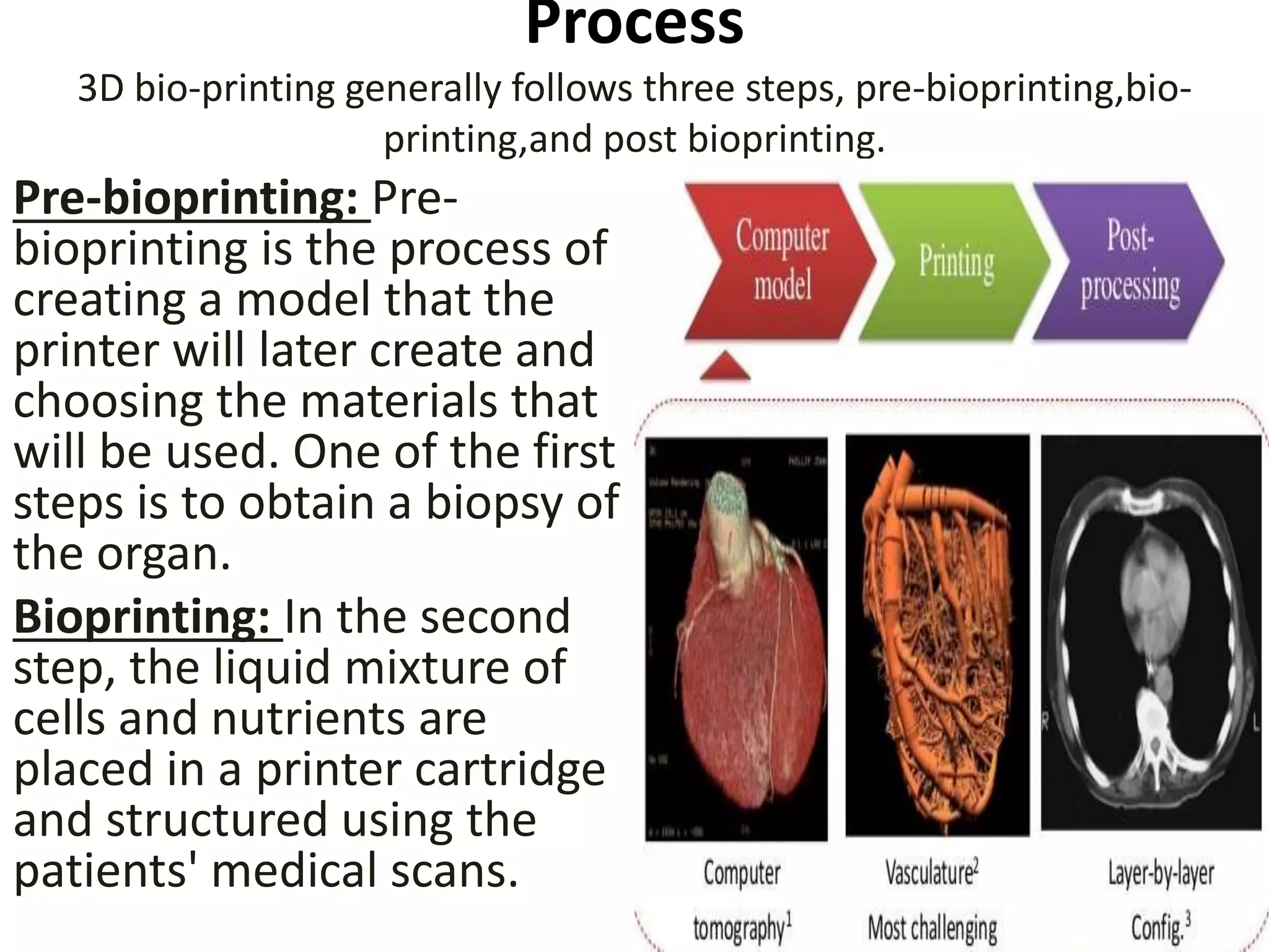 3D Organ Printing Technology | PPTX