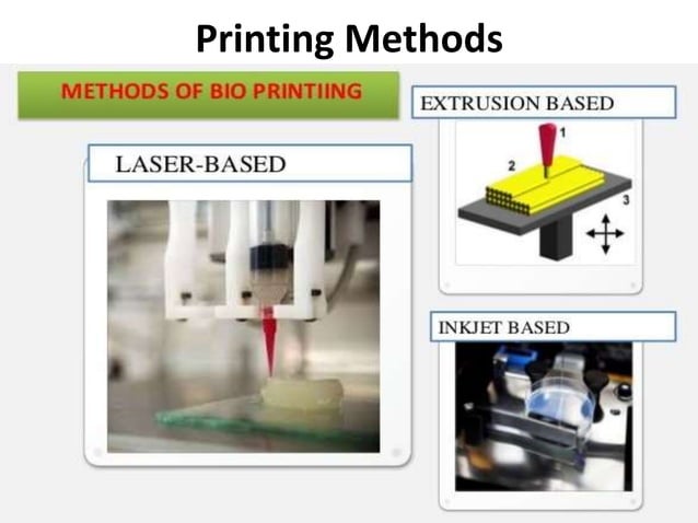 3D Organ Printing Technology | PPTX