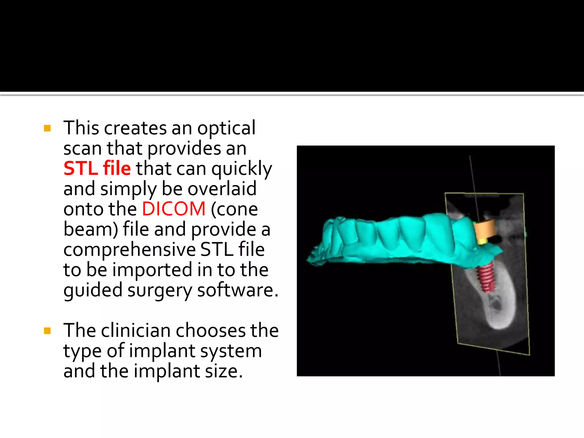 3D printing in dentistry | PPTX