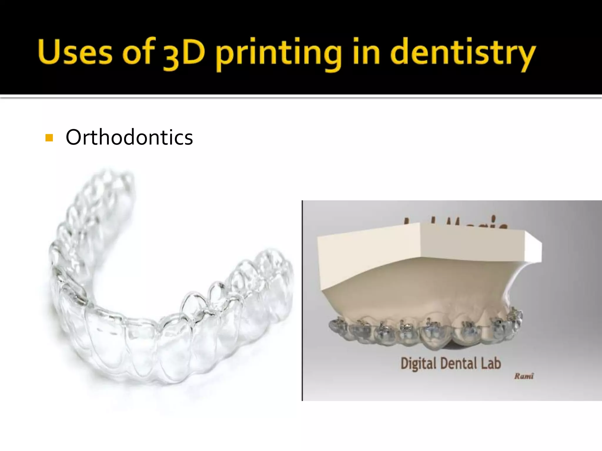 3D printing in dentistry | PPTX
