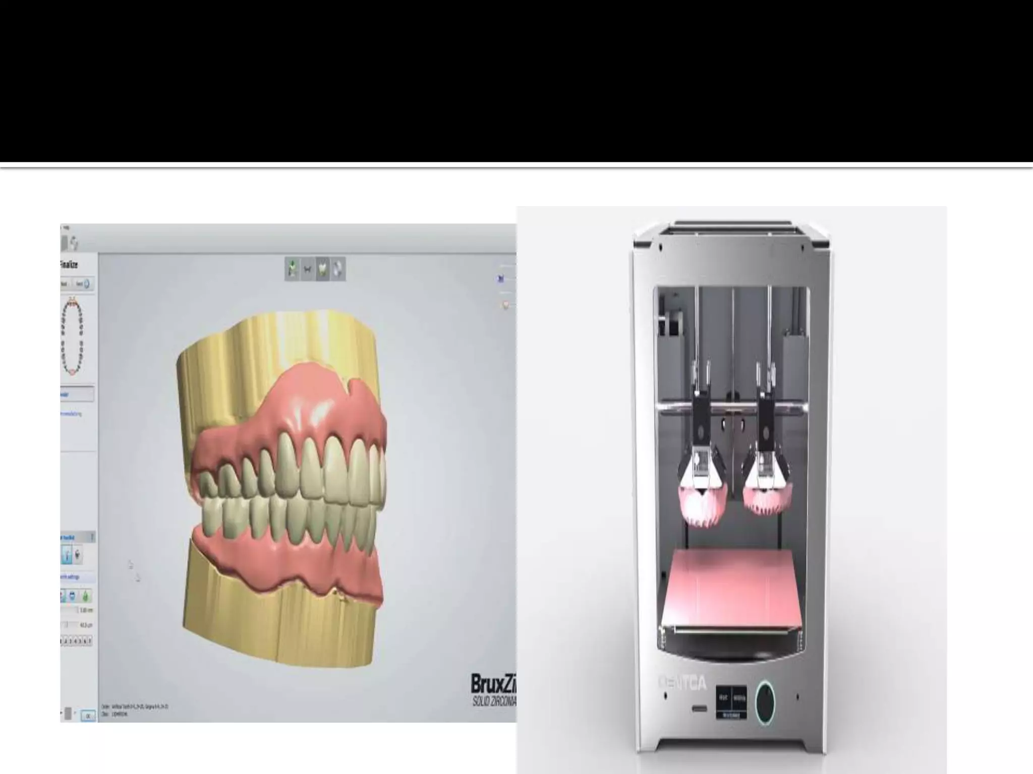 3D printing in dentistry | PPTX