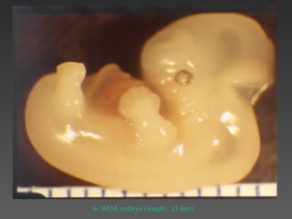 3D Reconstruction of Embryo Hearts for Model Validation | PPT ...
