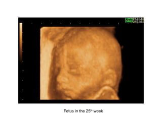 3D UltraSound Image of Fetus | PPS