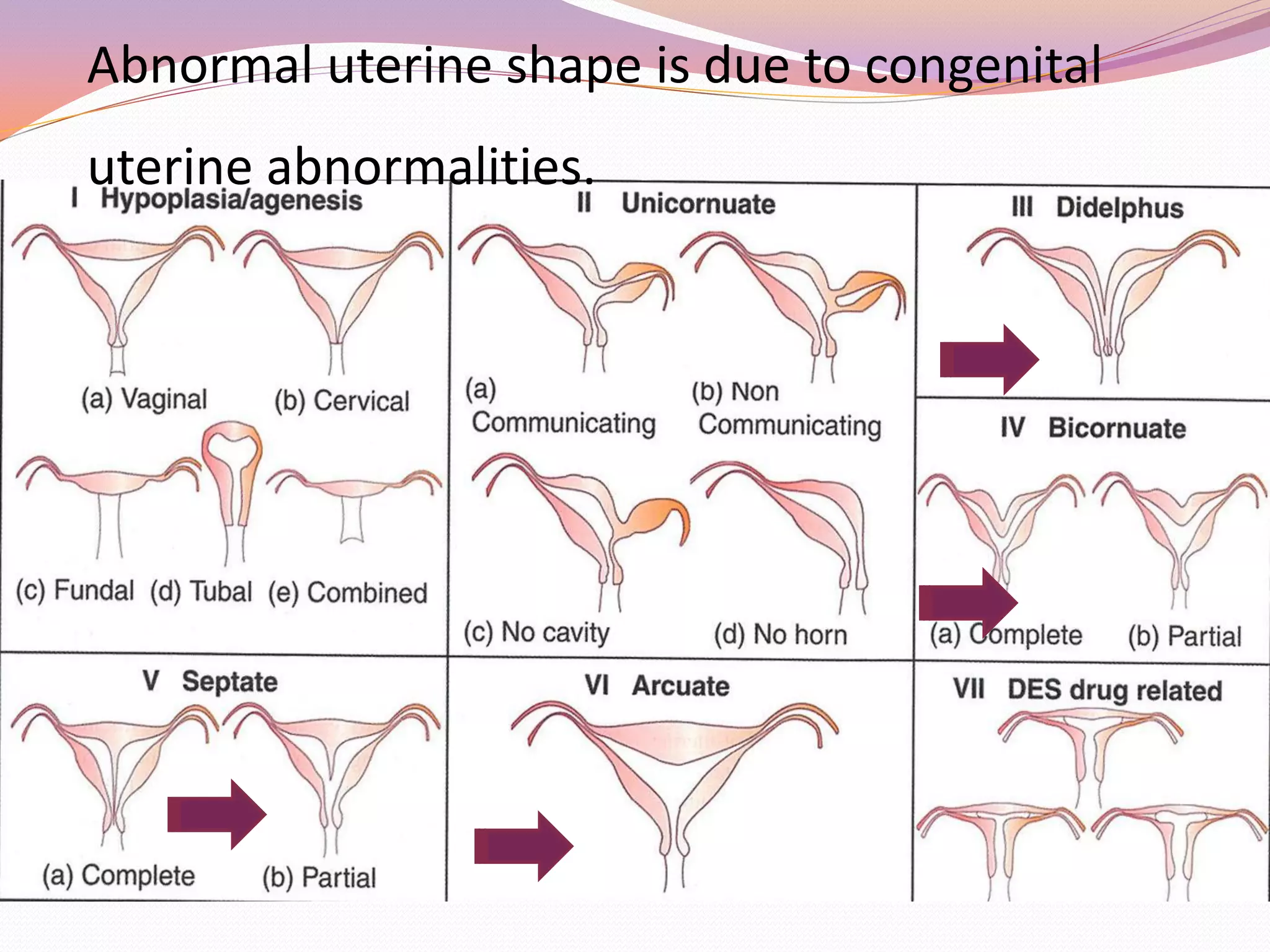 3 D Ultrasound in reproductive medicine | PDF