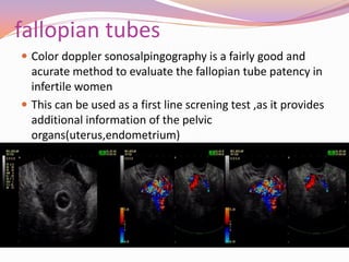 3 D Ultrasound in reproductive medicine | PDF