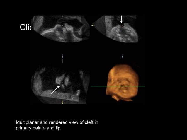 3d usg.pptx couple cool digital too too good ohoho | PPT