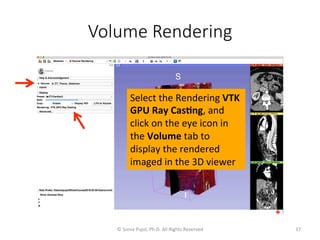 3DVisualizationDICOM_Slicer4.10_SoniaPujol.pdf