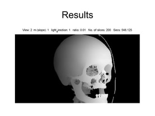 3D visualisation of medical images | PPT