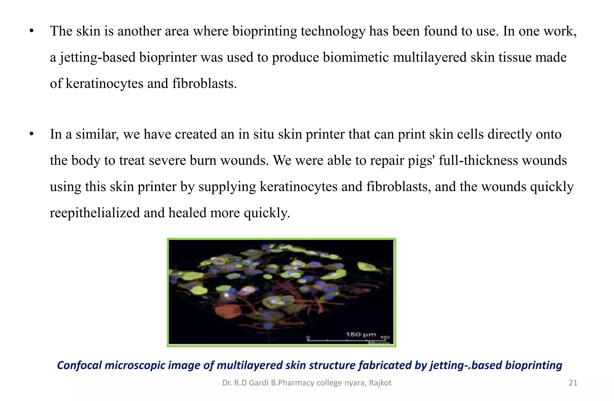 3D BIOPRINTING: PRINCIPLE, TECHNIQUES AND IT’S APPLICATION IN HUMAN ...