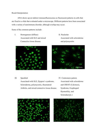 Anti Nuclear Factor Case Study | PDF
