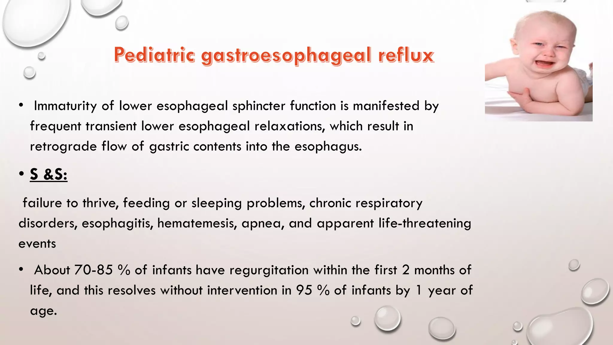Gastro-esophageal Reflux Disease | PDF