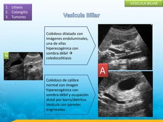 3 ecografía abdominal patologica | PDF