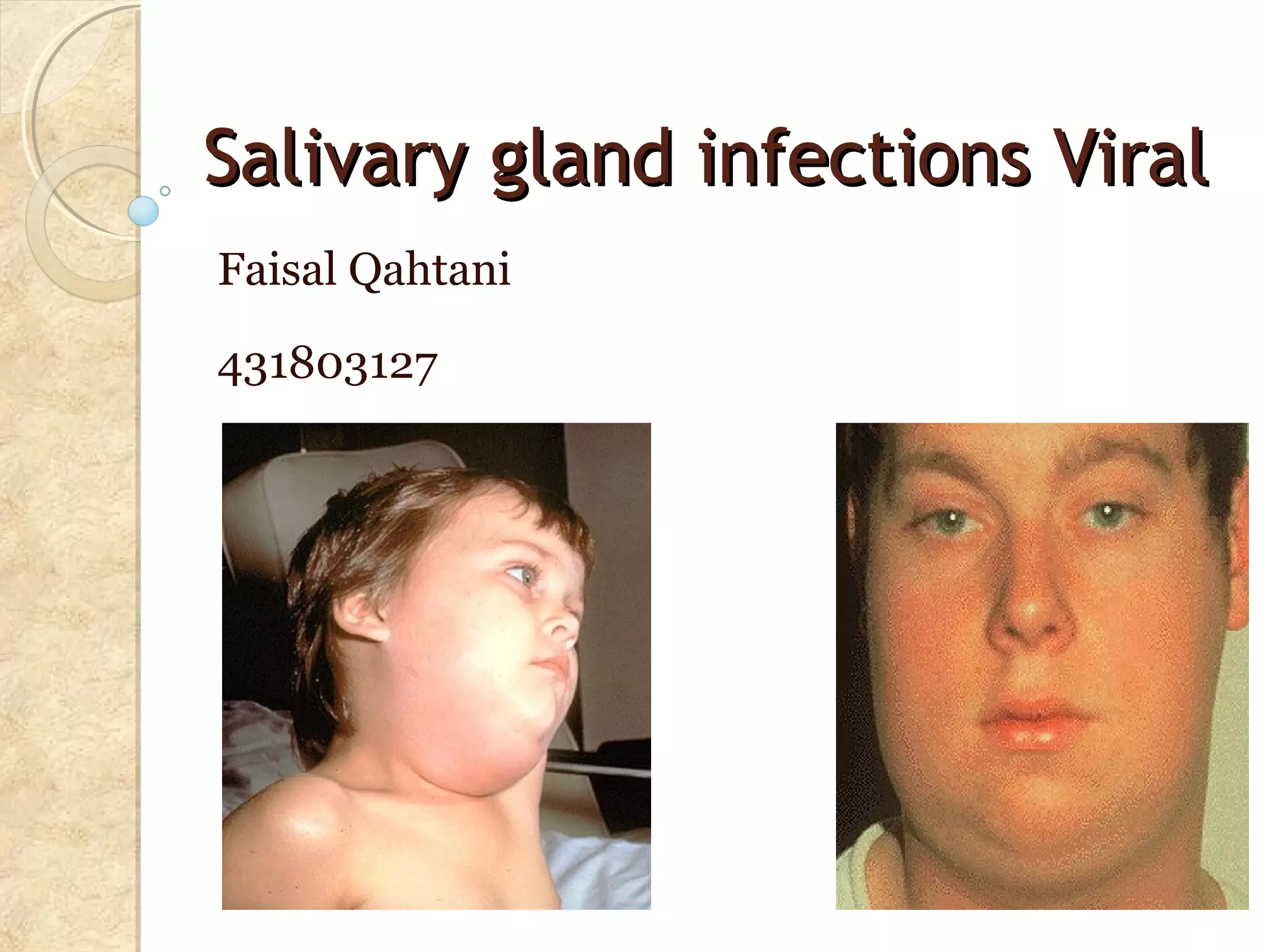 Salivary gland Viral infections | PPT