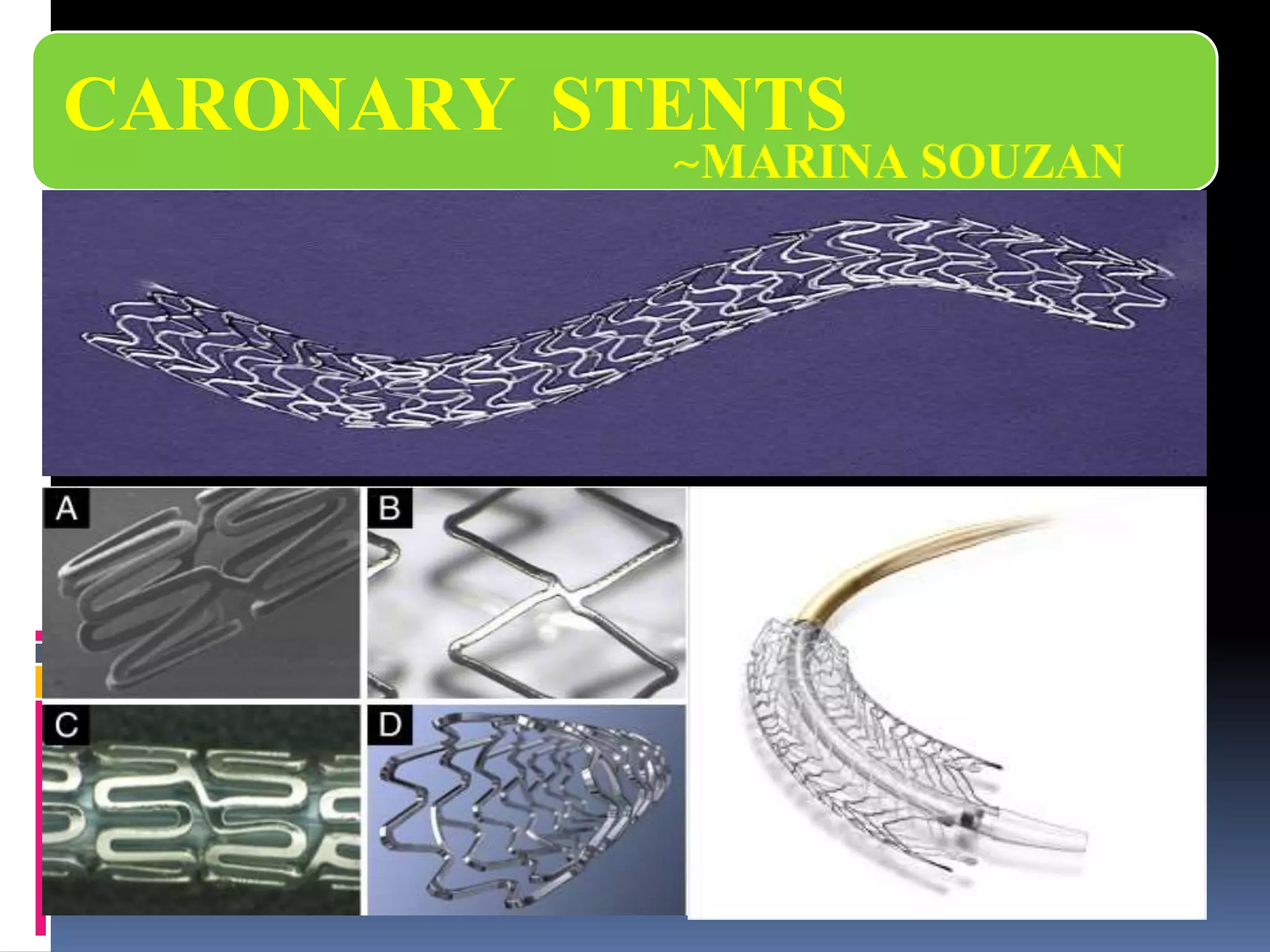 Stents3 | PPTX | Heart and Cardiovascular Diseases | Diseases and ...