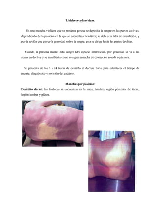 3era actividad medicina legal investigacion michelle | PDF