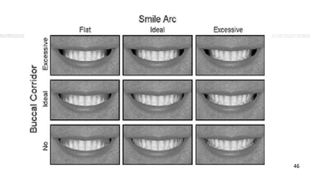 3 esthetic consideration | PPT