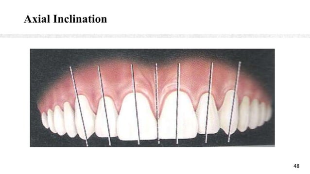 3 esthetic consideration | PPT