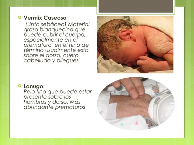 3 examen fisico del recien nacido | PPT 3 examen fisico del recien nacido | PPT