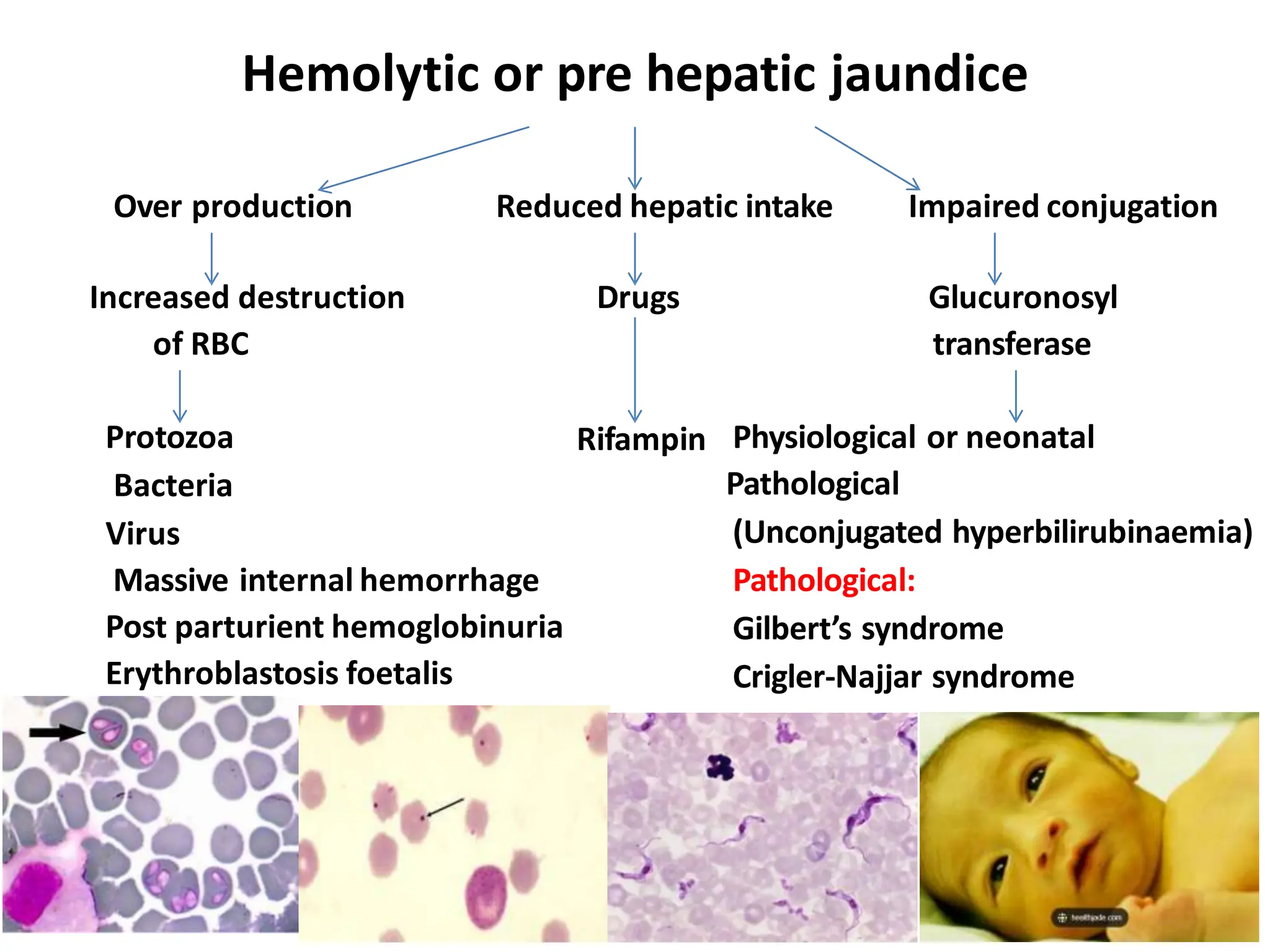 Jaundice pptx Veterinary pathology important | PDF