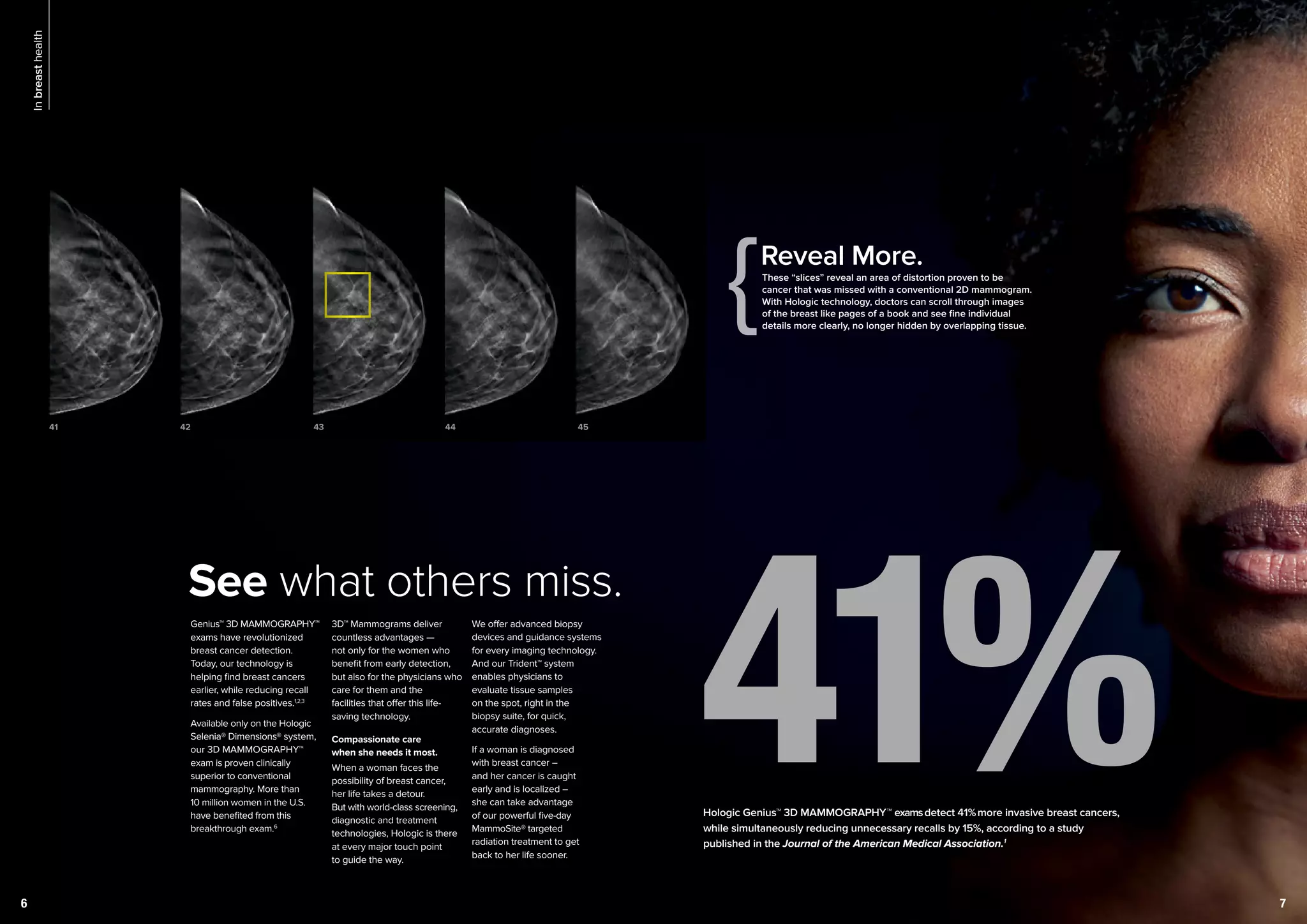 Hologic Corporate Brochure | PDF