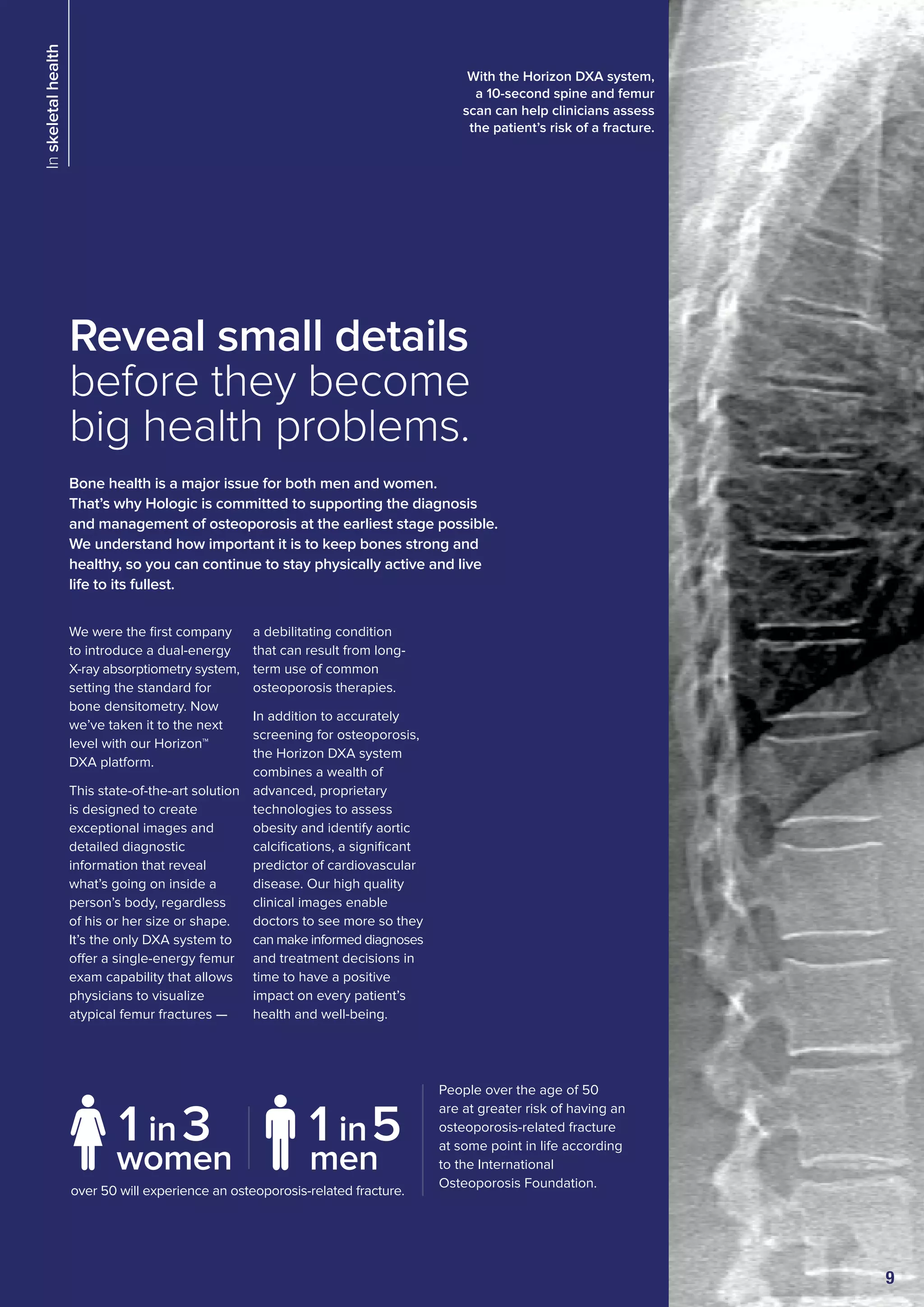 Hologic Corporate Brochure | PDF