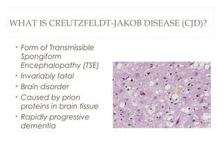 CJD Project final 4.16.15