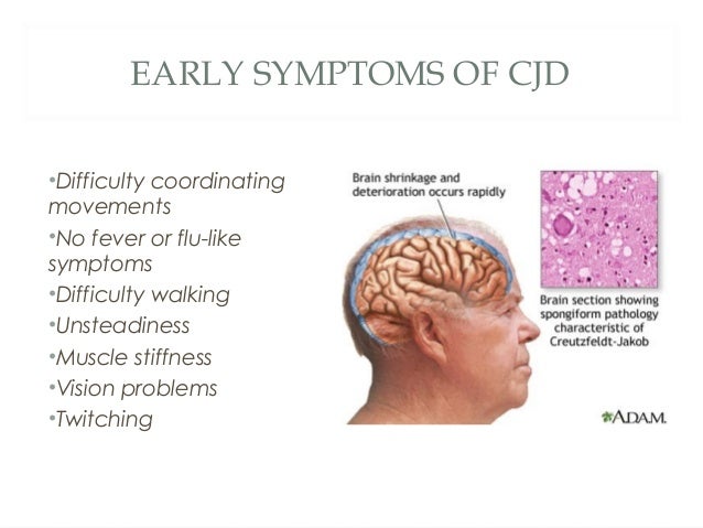 CJD Project final 4.16.15