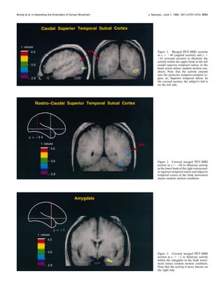 Eva Bonda et al Amygdala & Biological Motion, Journal of Neuroscience, 1996 | PDF