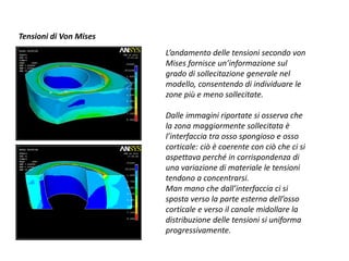 Design of prostheses and artificial organs_Zito Antonella 26-06-2012 | PDF