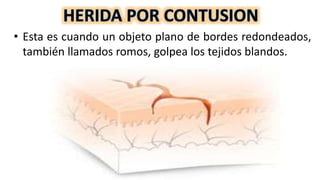 SUTURAS | PDF