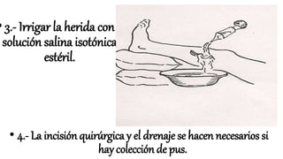 heridas y suturas | PPTX