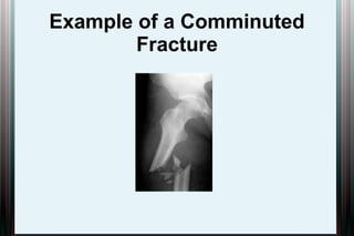3 fracture types | ODP