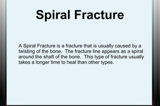 3 fracture types | ODP