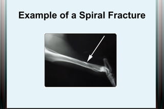 3 fracture types | ODP