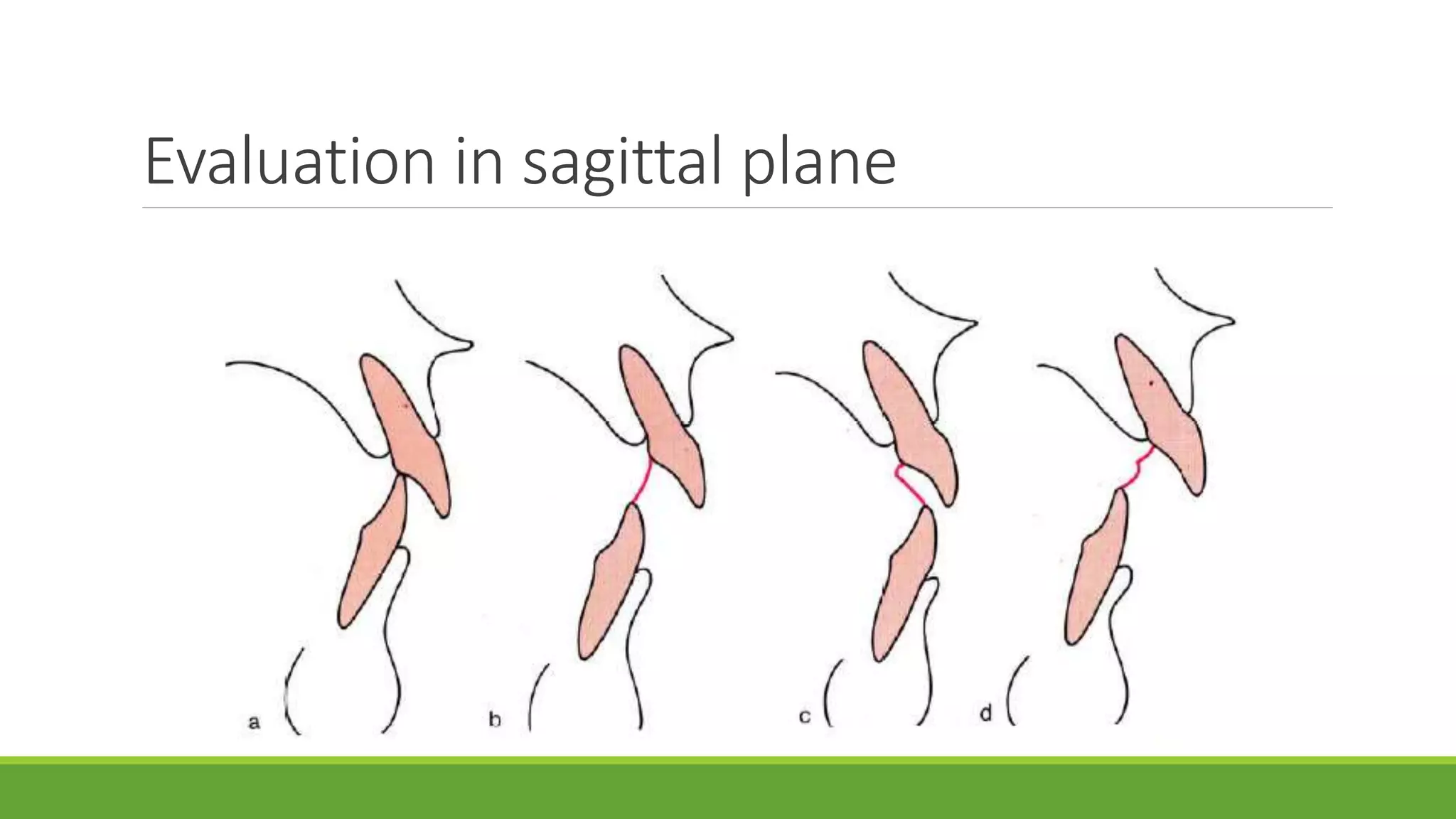functional examination | PPTX