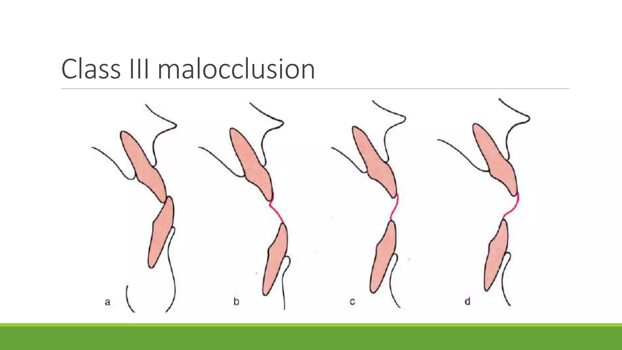 functional examination | PPTX