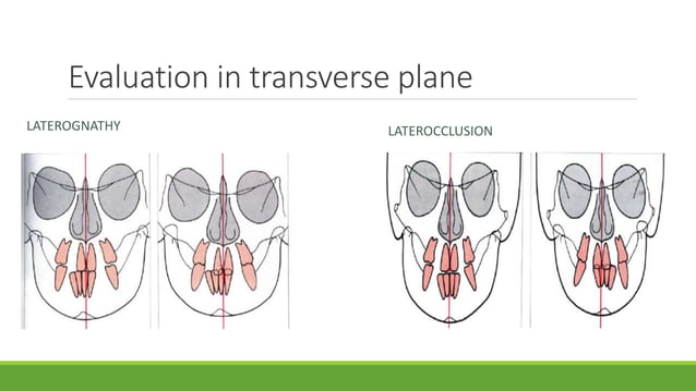 functional examination | PPT