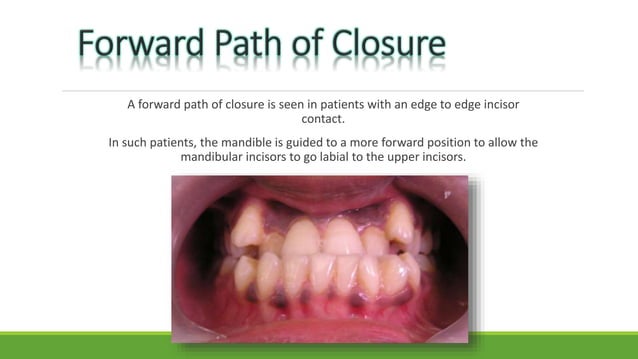 functional examination | PPTX