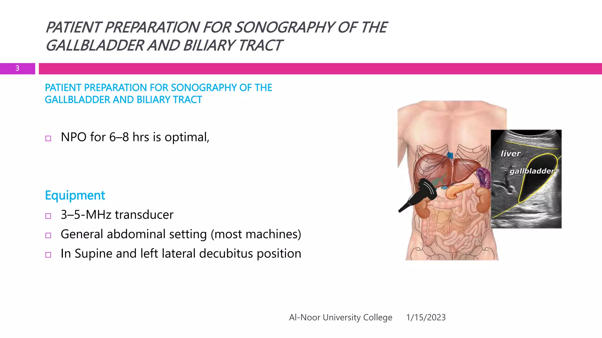 sonography of gallbladder | PPTX