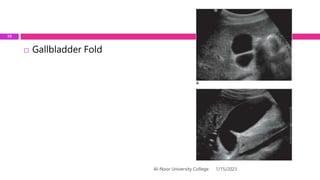 sonography of gallbladder | PPTX