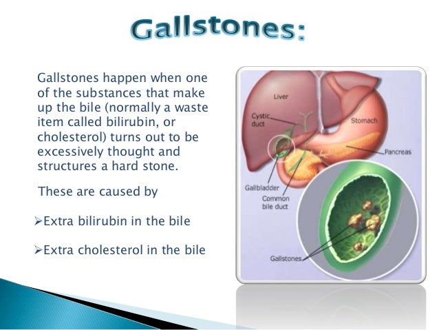 3 gallbladder problem and symptoms