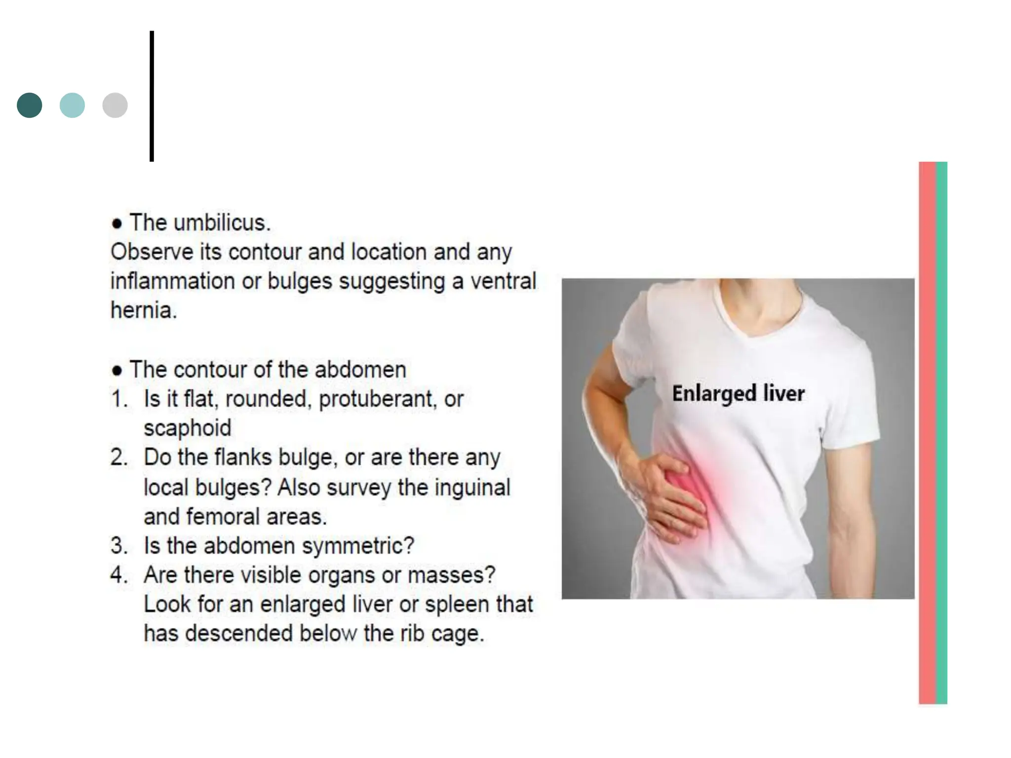 ASSESSMENT OF THE ABDOMEN, INSPECTION, AUSCULTATION, PERCUSSION ...