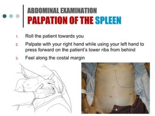 ASSESSMENT OF THE ABDOMEN, INSPECTION, AUSCULTATION, PERCUSSION ...