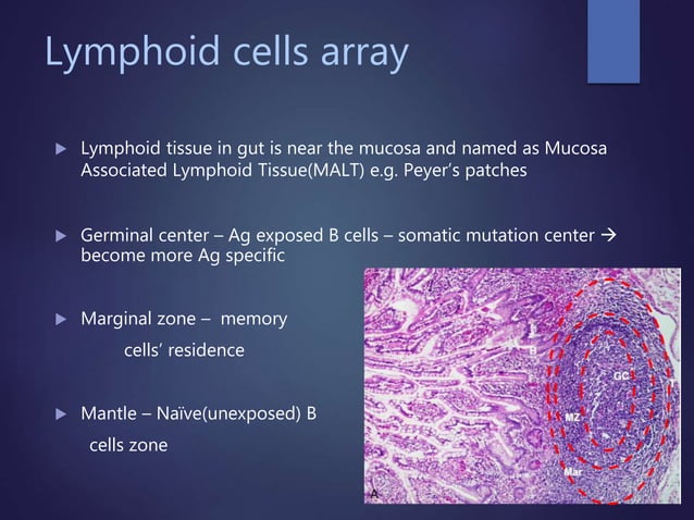 Lymphoma gi | PPT