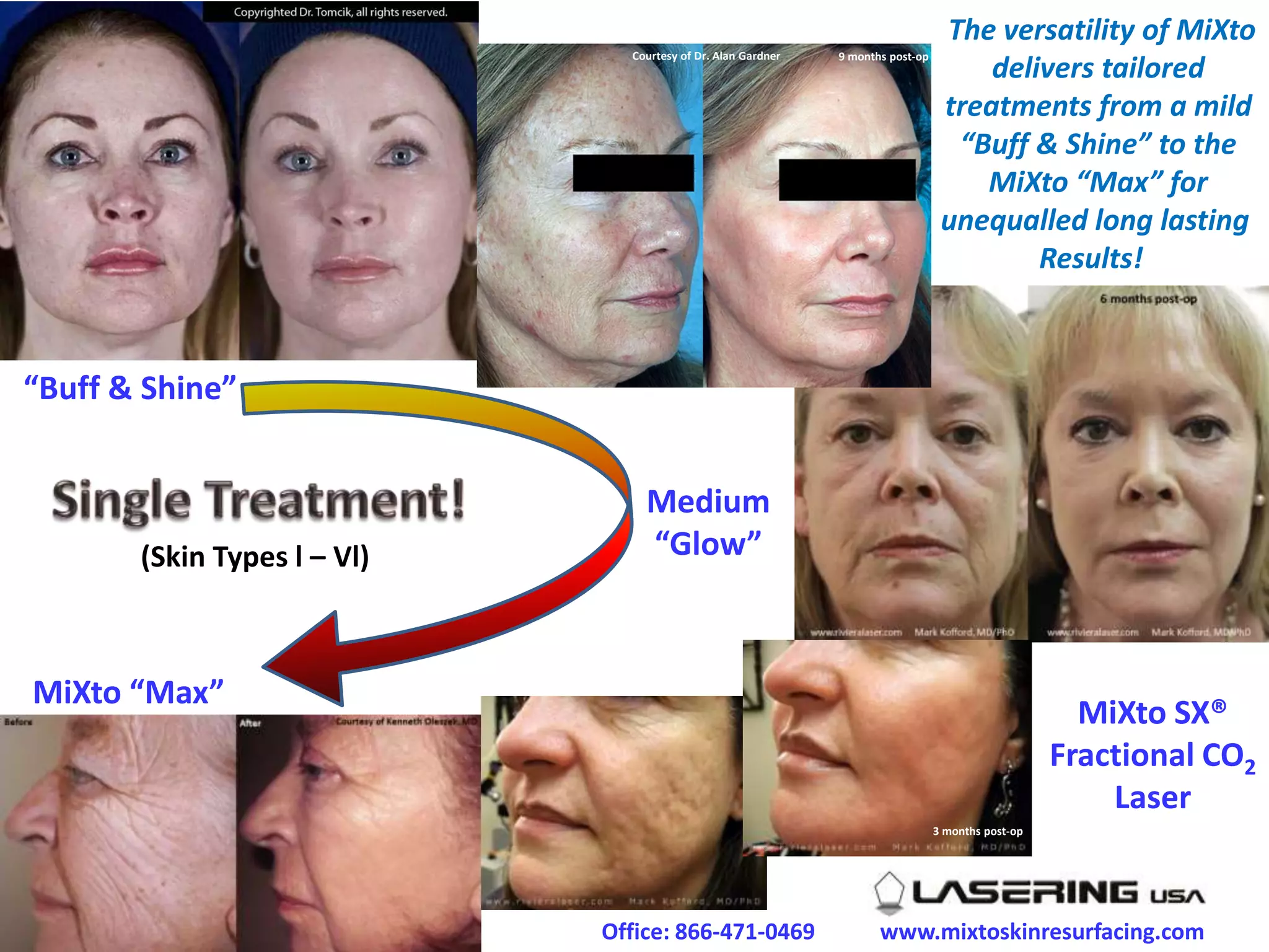 Before And After Slide Presentation Ppt